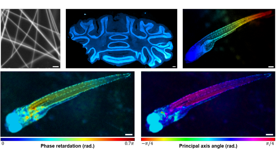Quantum imaging of biological organisms through spatial and ...