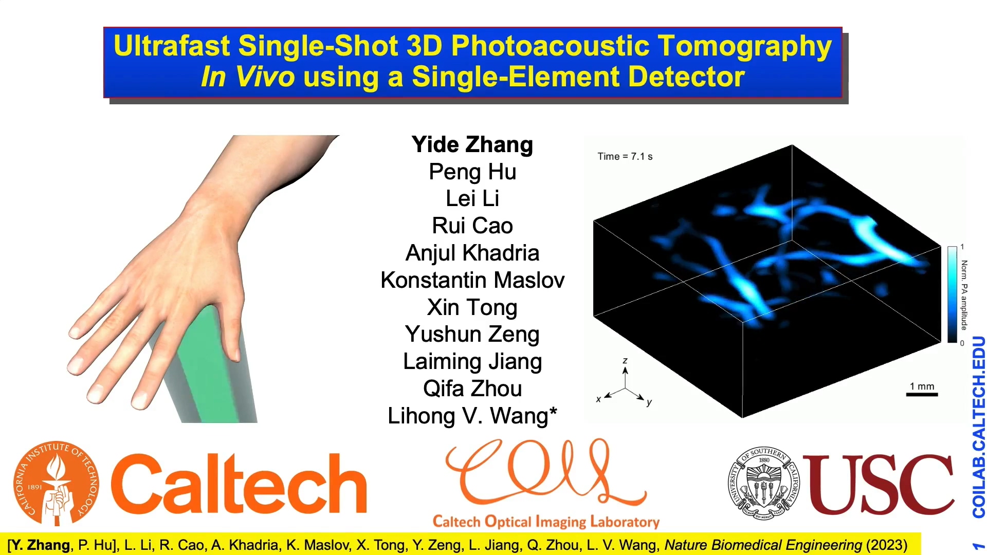Ultrafast single-shot 3D photoacoustic tomography in vivo using a ...
